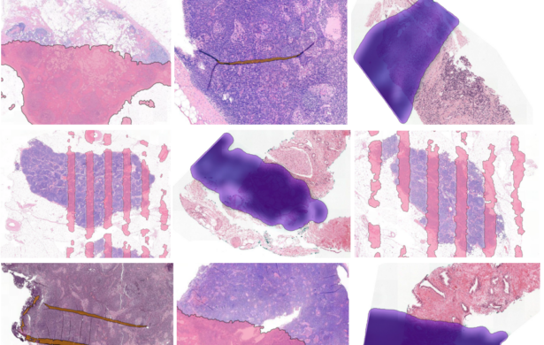 Clinical Diagnostics - Aiosyn