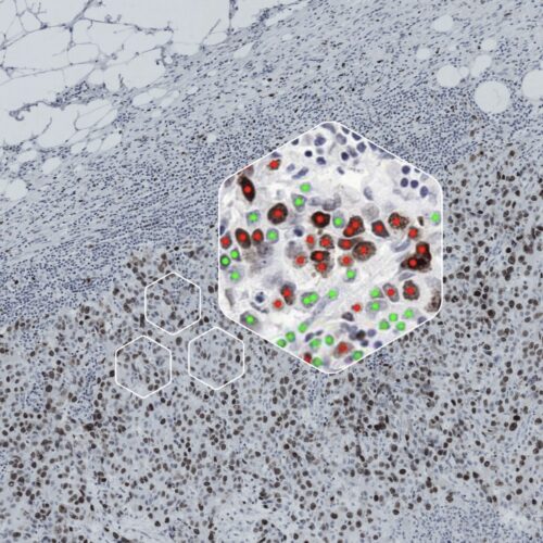 Achieve more perspective - Aiosyn