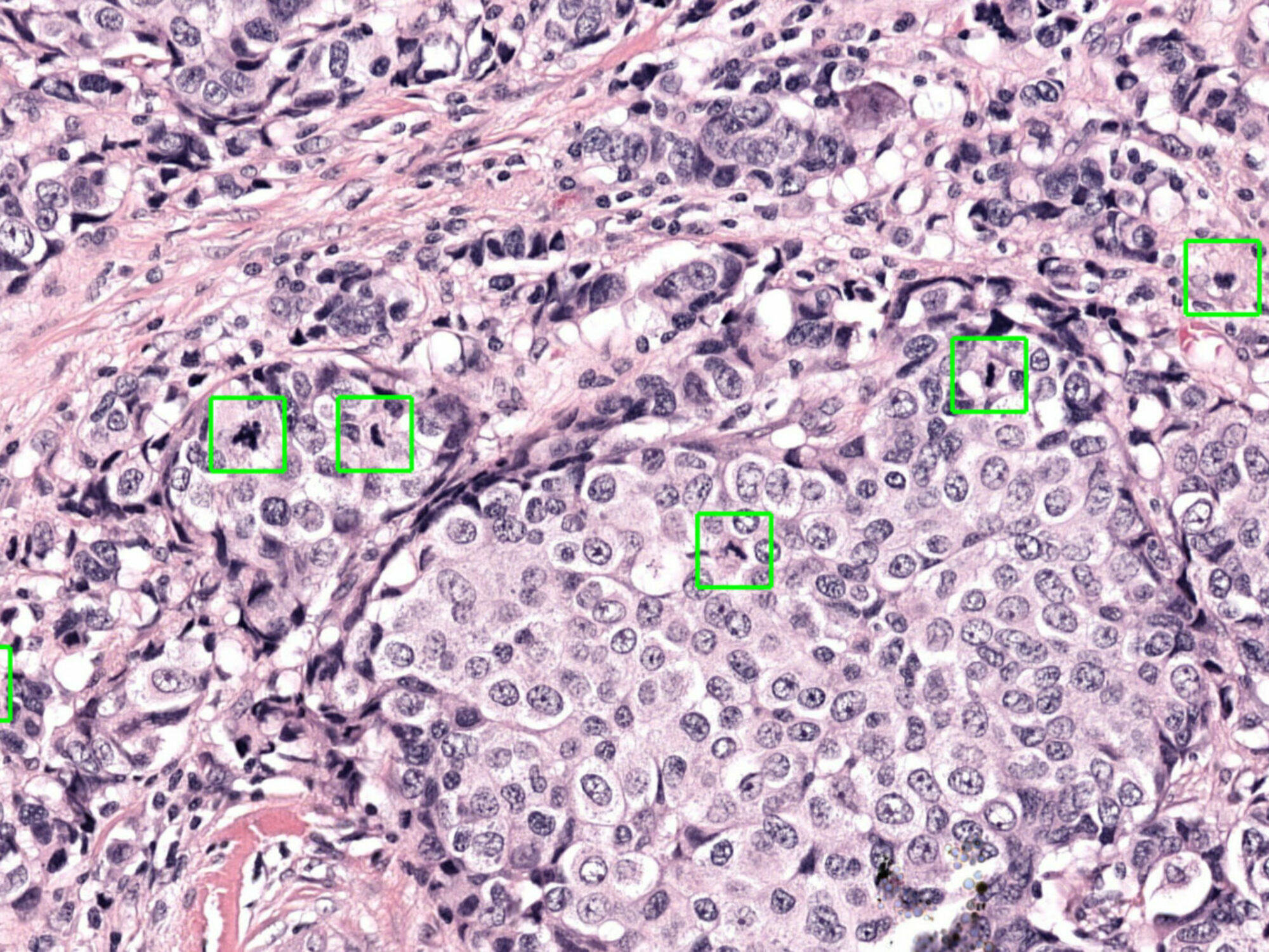 Mitotic figure counting - Aiosyn