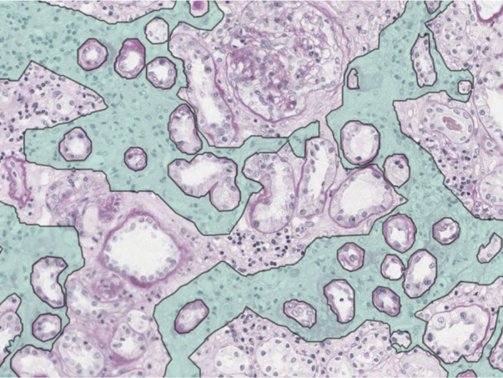 Achieve more perspective - Aiosyn