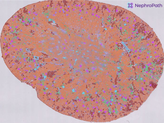 NephroPath platform - Aiosyn